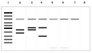 Agarose Gel Electrophoresis: Definition, Principle, Process, Protocol ...