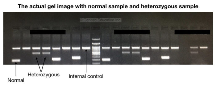 ARMS or Allele-Specific PCR- Principle, Procedure, Protocol, Applications and Limitations