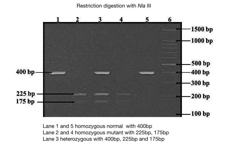 Part 2: Analysing and Interpreting (Agarose) Gel Electrophoresis Results