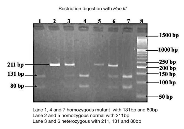 Part 2: Analysing and Interpreting (Agarose) Gel Electrophoresis Results