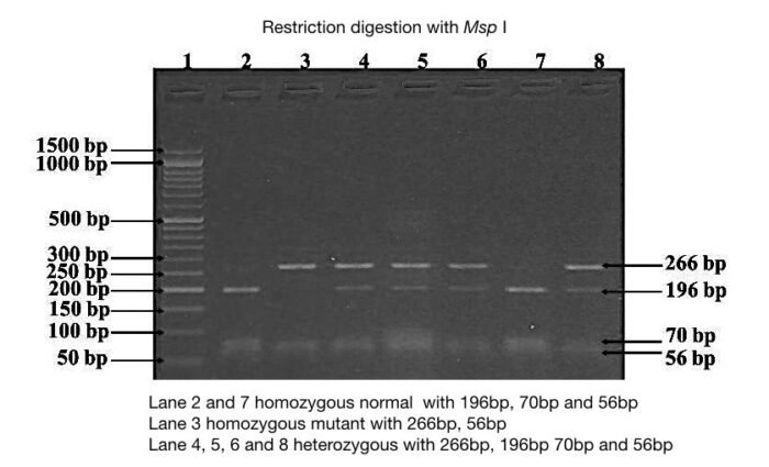 Part 2: Analysing and Interpreting (Agarose) Gel Electrophoresis Results