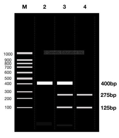 Part 2: Analysing and Interpreting (Agarose) Gel Electrophoresis Results