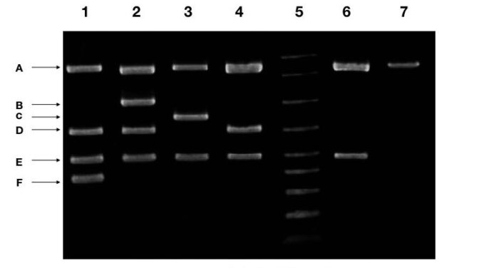 Part 2: Analysing and Interpreting (Agarose) Gel Electrophoresis Results