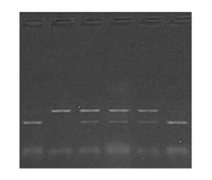 What is a DNA ladder? And How To Prepare It? (A Complete Protocol)