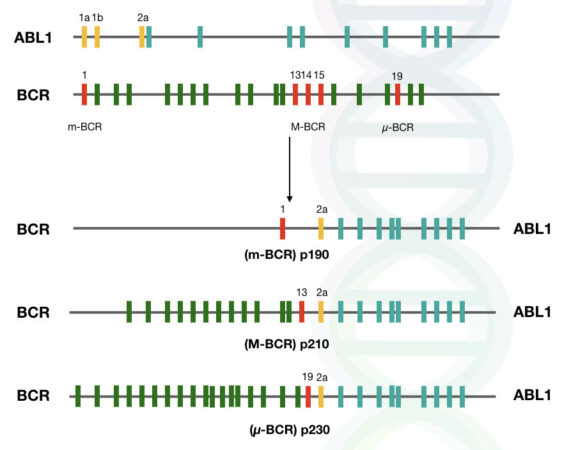Philadelphia Chromosome: BCR-ABL1 Fusion Gene and Its Role in Cancer
