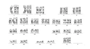 A Brief Introduction To Cytogenetics [Karyotyping, FISH and Microarray]