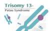 Trisomy 13(Patau Syndrome)- Definition, Causes, Symptoms, Life ...