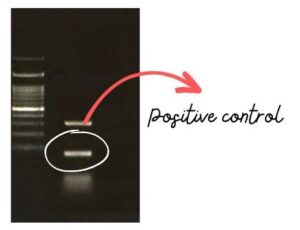 Type of PCR Controls- Negative, Positive and Internal Controls ...