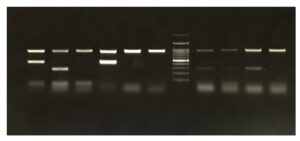 Type of PCR Controls- Negative, Positive and Internal Controls ...