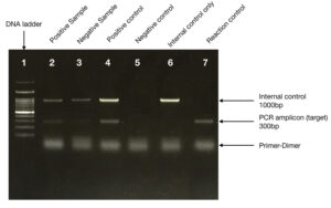 Type of PCR Controls- Negative, Positive and Internal Controls ...