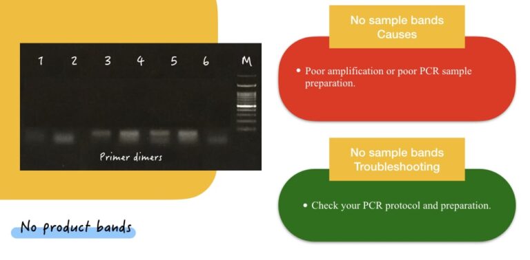 Common Issues in DNA/RNA Gel Electrophoresis and Troubleshooting ...