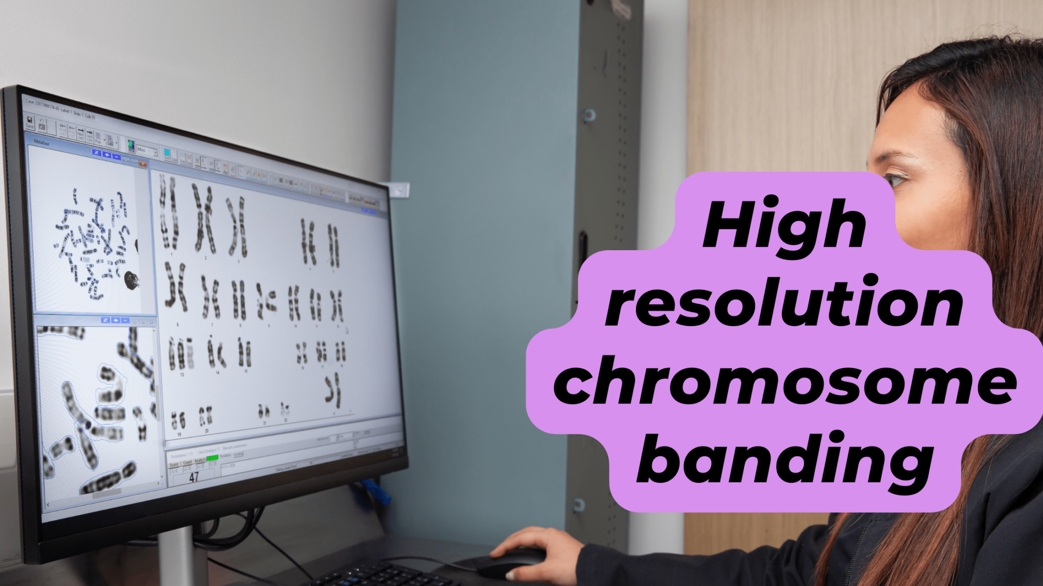 EtBr For High-Resolution Chromosome Banding – Genetic Education
